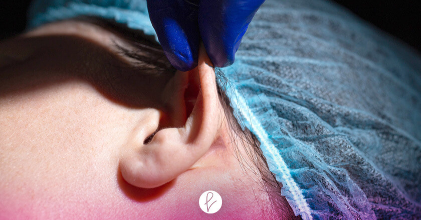 Lobuloplastia Cirug a Para Reparar El L bulo De La Oreja Rasgado Lobuloplastia Cirug a Para Reparar El L bulo De La Oreja Rasgado